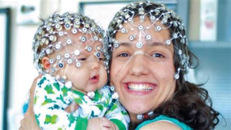 Eeg Hyperscanning Magstim