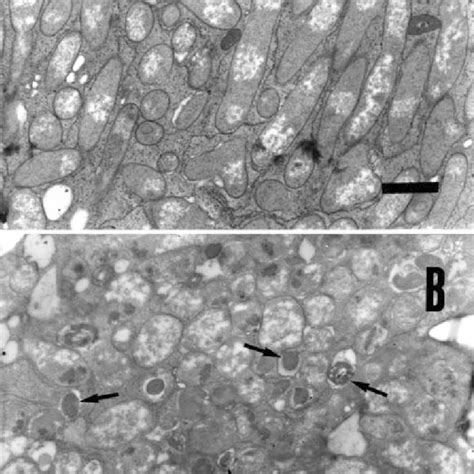 A B Electron Micrographs Showing Intracellular Bacteria From Nodule