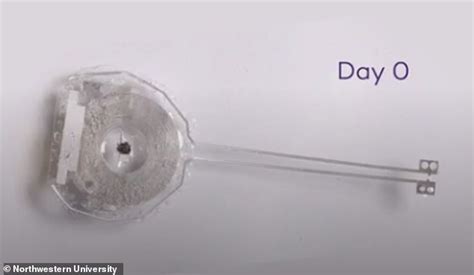 Worlds First Wireless Battery Free Fully Implantable Pacemaker Dissolves Within Seven Weeks