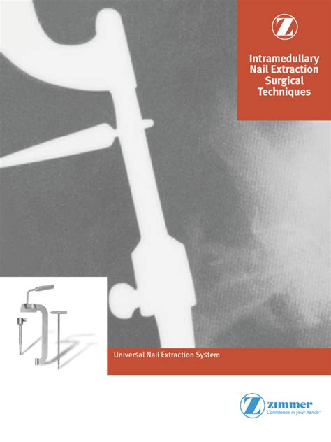 Intramedullary Nail Extraction Surgical Technique Pdf Nut Hardware
