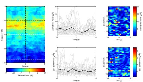12 Eeg Data Of Subject 9 Visualization Of Mean Spectrogram Mu And Download Scientific