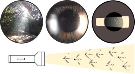 Anterior Chamber Inflammation Grading Methods A Critical Review