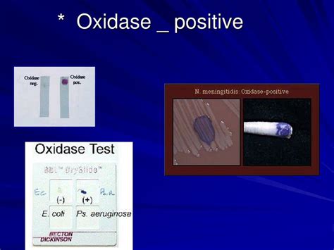Ppt Pseudomonas Identification Powerpoint Presentation Free Download Id3930059