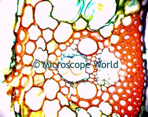 Microscope World This Is Wheat Rust Captured Under A Biological