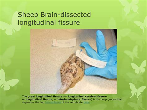 Sheep Brain Dissection And Label Pptx