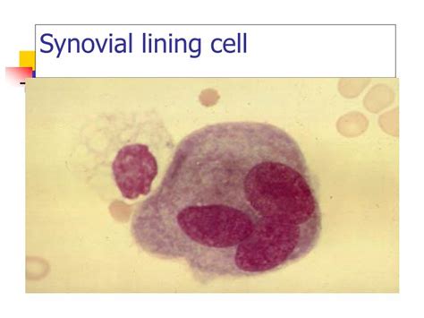 Ppt Synovial Fluid Powerpoint Presentation Id702385