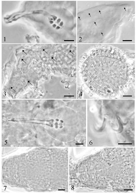 Macrobiotus Subintermedius Syntype Figs 1 4 1—bucco Pharyngeal Download Scientific