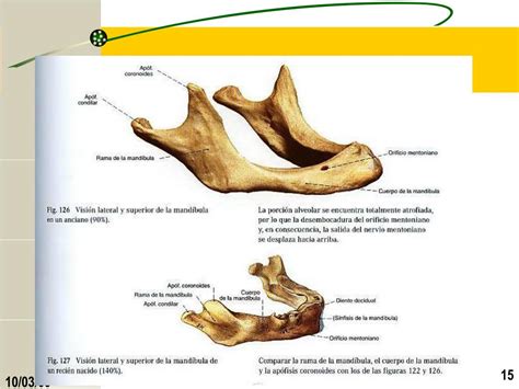 Ppt Delimite A La Fosa Infratemporal Enuncie El Contenido De La