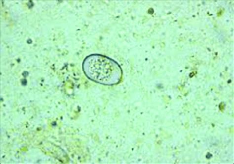 Oomycetes Microscope