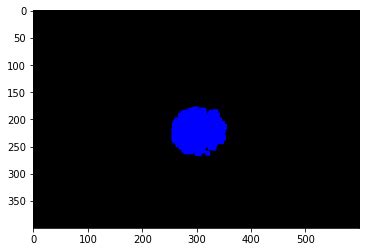 Python Image Processing Segmentation Of Optic Disc Stack Overflow