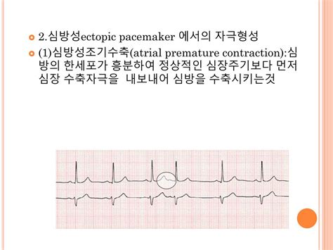 Ppt 심전도 Powerpoint Presentation Free Download Id 1731875