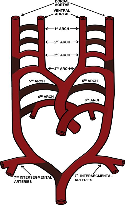 Congenital Variants And Anomalies Of The Aortic Archradiographics