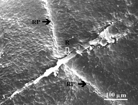 Palatal Seam R Future Raphe Palati And Palatal Ridge 3 Rp Rugae