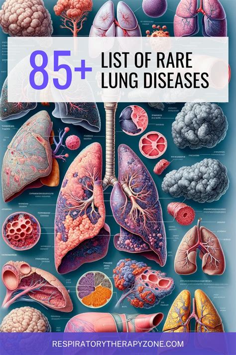 List Of Rare Lung Diseases And Disorders With Descriptions Lung