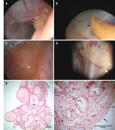 Macroscopic Laparoscopy A D And Microscopic Histology E F Download Scientific Diagram