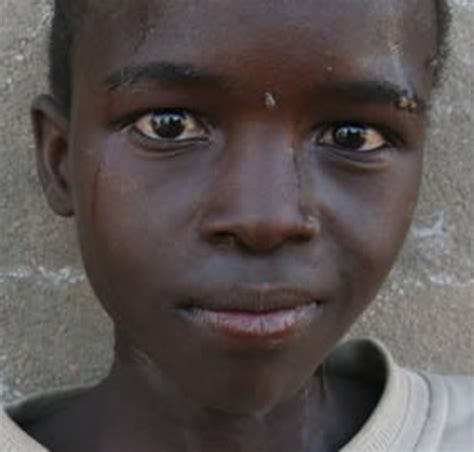 Colin Durrant Is Fundraising For Cord