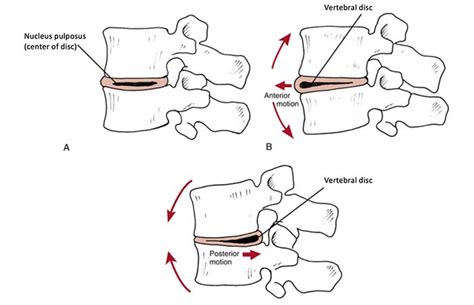 Why Isnt There A Safe And Effective Treatment For Neck Or Back Pain