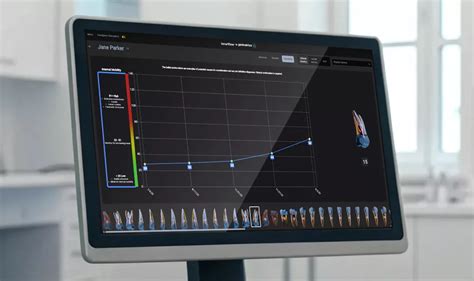Fda Cleared Tech For Measuring Internal Tooth Mobility Innerview Ai