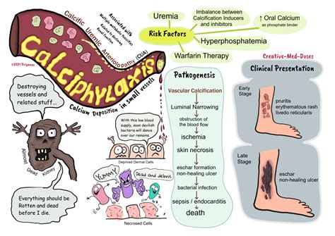 Calciphylaxis Or Calcific Uremic Arteriolopathy In Ckd Creative Med Doses