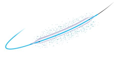 Support C Orbusneich