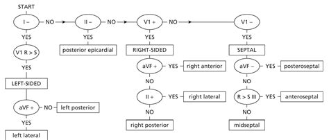 6 An Algorithm For Locating The Accessory Pathway Based On