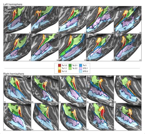 Cytoarchitectonic Areas Of Morosan Et Al 2001 Morosan Et Al 2005