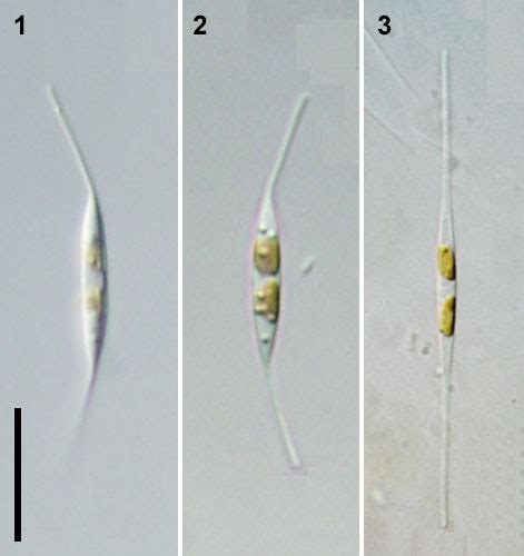 Ceratoneis Closterium