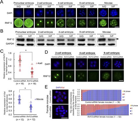 Impaired Imprinted X Chromosome Inactivation Is Responsible For The Skewed Sex Ratio Following