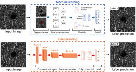 Figure 5 From Automatic Segmentation And Classification Methods Using Optical Coherence