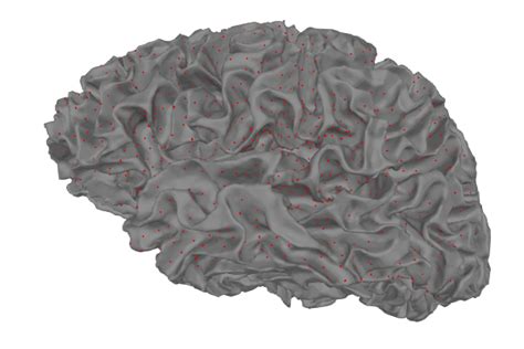 The Role Of Dipole Orientations In Distributed Source Localization — Mne 111 Documentation