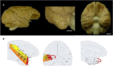 Frontiers Anatomical Pathways For Auditory Memory Ii Information From Rostral Superior