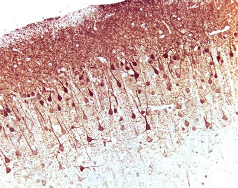 Purified Mouse Anti Erk Pan Erk