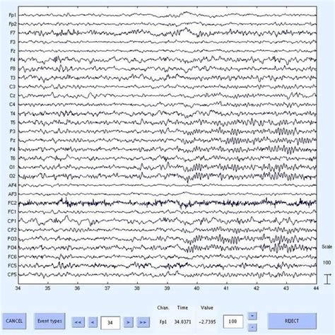 同步脑电 功能磁共振（eeg Fmri）伪影去除方法及工具箱介绍 知乎