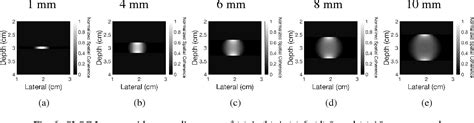 figure 6 from additive noise models for photoacoustic spatial coherence