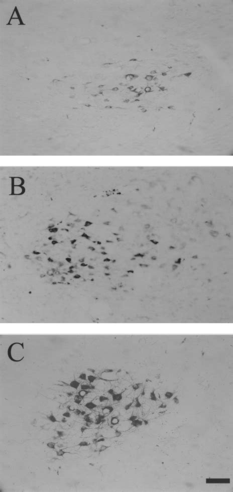 Staining Of Midbrain After Hrp Retrograde Tracing Of Rsn 8 Weeks After Download Scientific