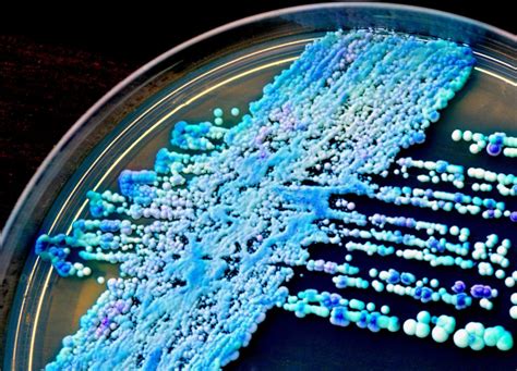 Pathogenic Yeast Cultivates A Disease Resistant Gut