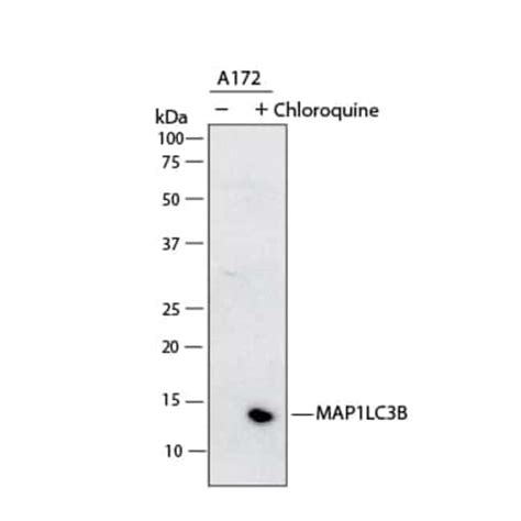 Human Lc3b Antibody R D Systems 100 μg Unconjugatedantibodies