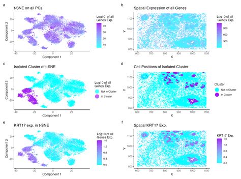 identification of epithelial cell cluster in breast cancer tissue of