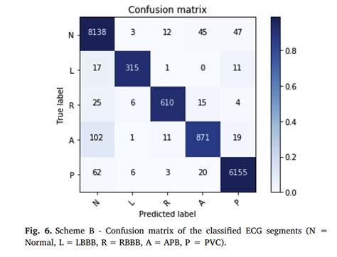 Automated Diagnosis Of Arrhythmia Using Combination Of Cnn And