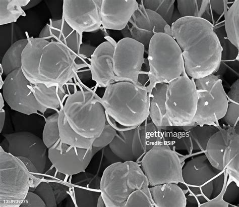 Gonorrhea Bacteria Photos And Premium High Res Pictures Getty Images