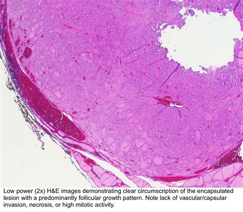 Thy3a Pvptc Niftp Rcpath Document