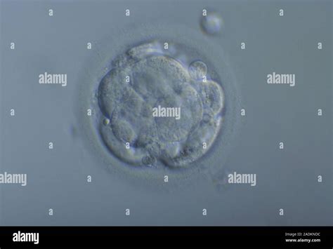 Morula Embryo Light Micrograph Of A Human Embryo At The Morula Stage