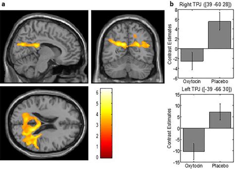 Neural Activity In The Temporoparietal Junction A Neural Activity