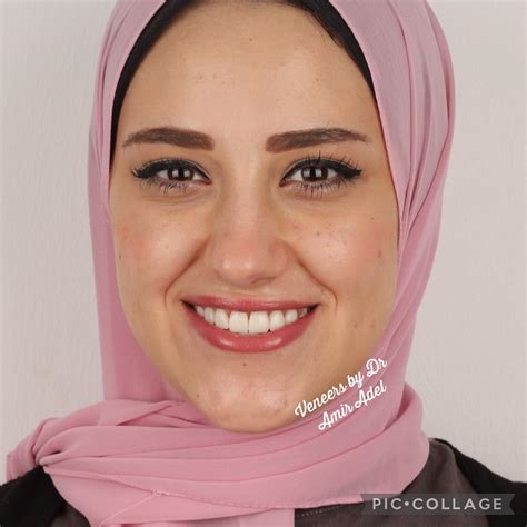 Dr Amir Adel This Patient Came To Dr Amir Adel