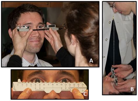 A Clinical Exophthalmometry Patient Upright B Clinical Download Scientific Diagram