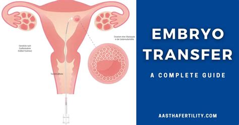 Embryo Transfer A Complete Guide 2023 Aastha Fertility Center