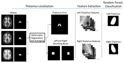 Thalamus Segmentation Using Multi Modal Feature Classification