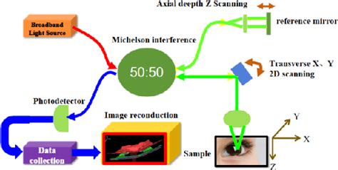 Figure 1 From Multi Layer Segmentation Method For Ophthalmic Oct Images