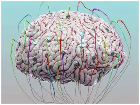What Is Biocomputer Brain Computer Organoid Better Then Artificial Intelligence Organoid