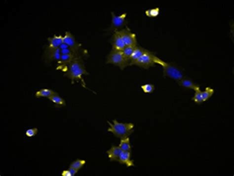 Moc22 Mouse Oral Squamous Cell Carcinoma Oscc Cell Line Scc471
